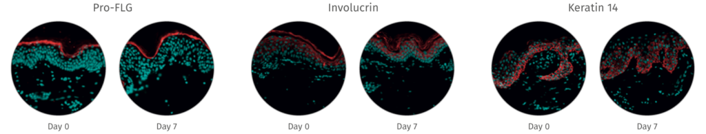 Human skin models with real human skin structure - Genoskin