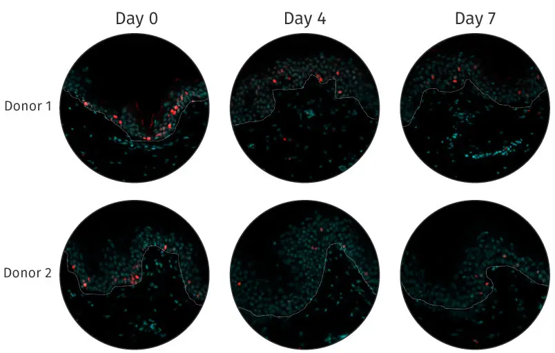 Test models offering live human skin response - Genoskin