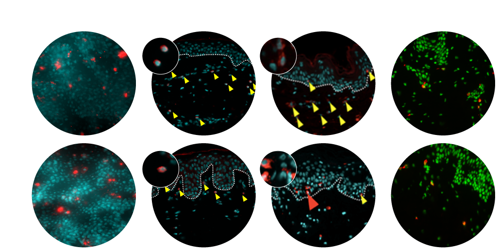 Test models offering live human skin response - Genoskin