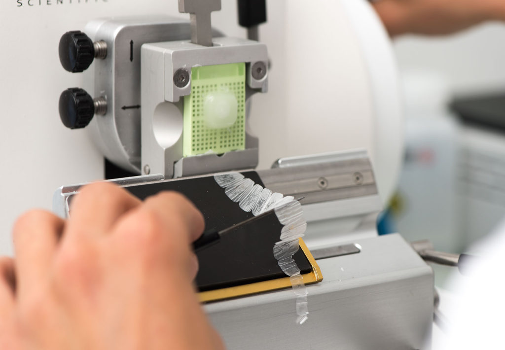 HistoSkin® Fully characterized FFPE human skin tissue blocks | Genoskin