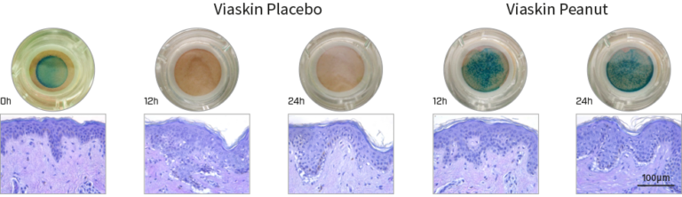 POSTER - NativeSkin®, an immunocompetent skin model to study antigen ...