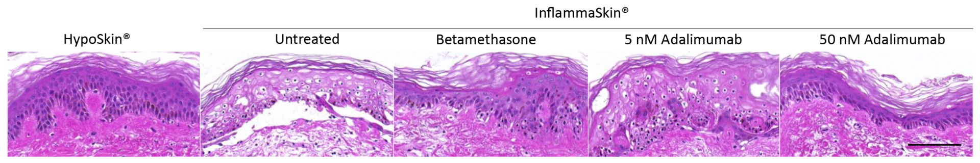 InflammaSkin® to study the efficacy of anti-inflammatory drugs | Genoskin