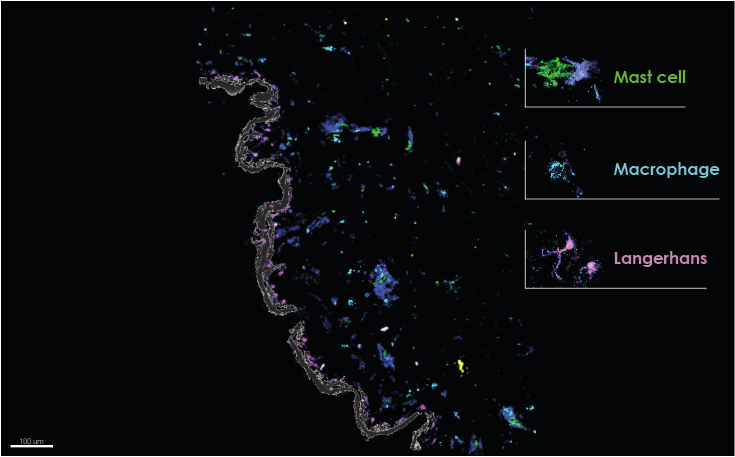 Top things found in native skin (vs reconstructed human skin) - Genoskin