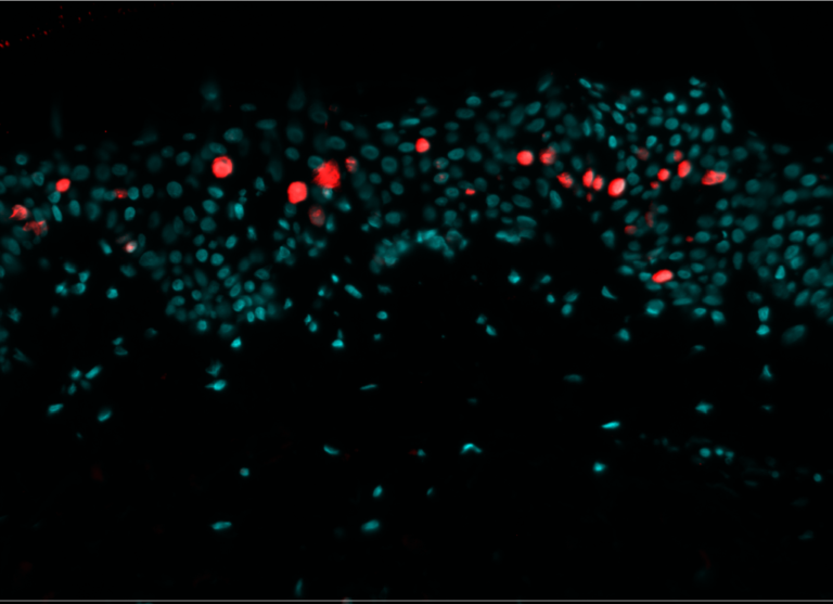 Human skin models with live human skin response - Genoskin