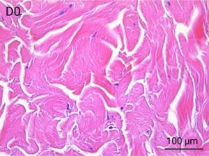 Human skin models with live human skin response - Genoskin